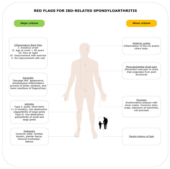 Joint Manifestations in Inflammatory Bowel Diseases, “Red Flags” for ...