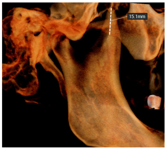 Cone Beam Computed Tomography Evaluation and Proposal of a Functional ...