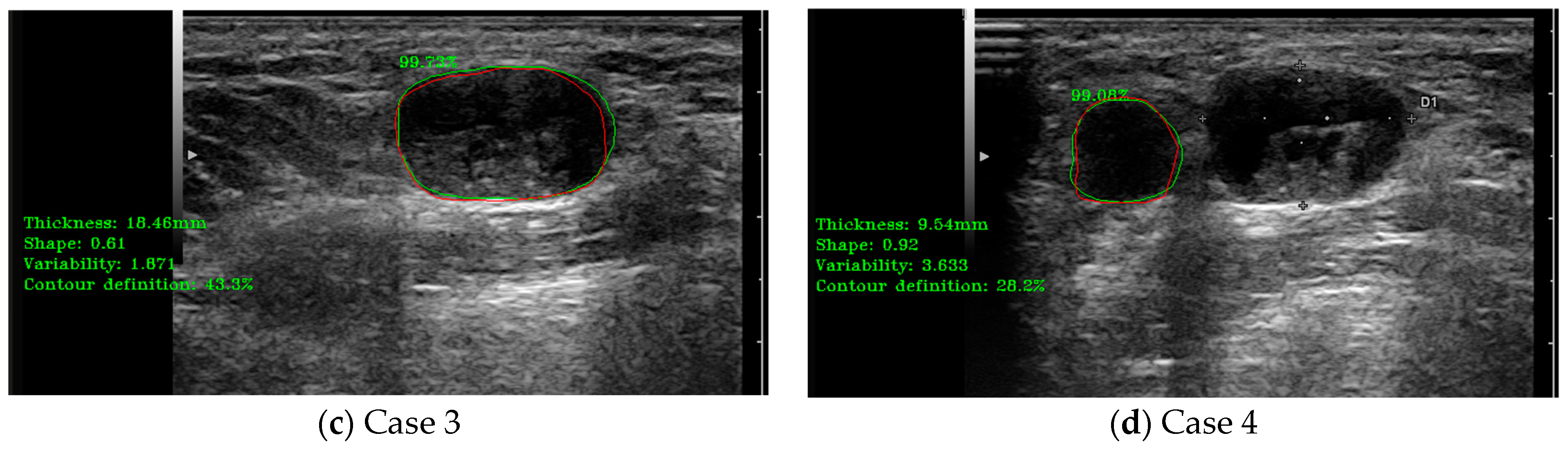 A Deep Learning-Based Detection and Segmentation System for Multimodal Ultrasound Images in the ...