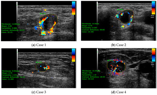 A Deep Learning-Based Detection and Segmentation System for Multimodal Ultrasound Images in the ...