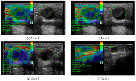 A Deep Learning-Based Detection and Segmentation System for Multimodal Ultrasound Images in the ...