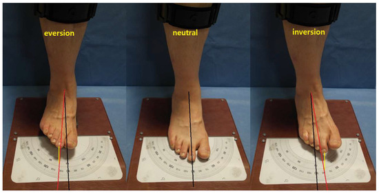 Which Measuring Method Is Better for Reflecting Subtalar Joint Stiffness?