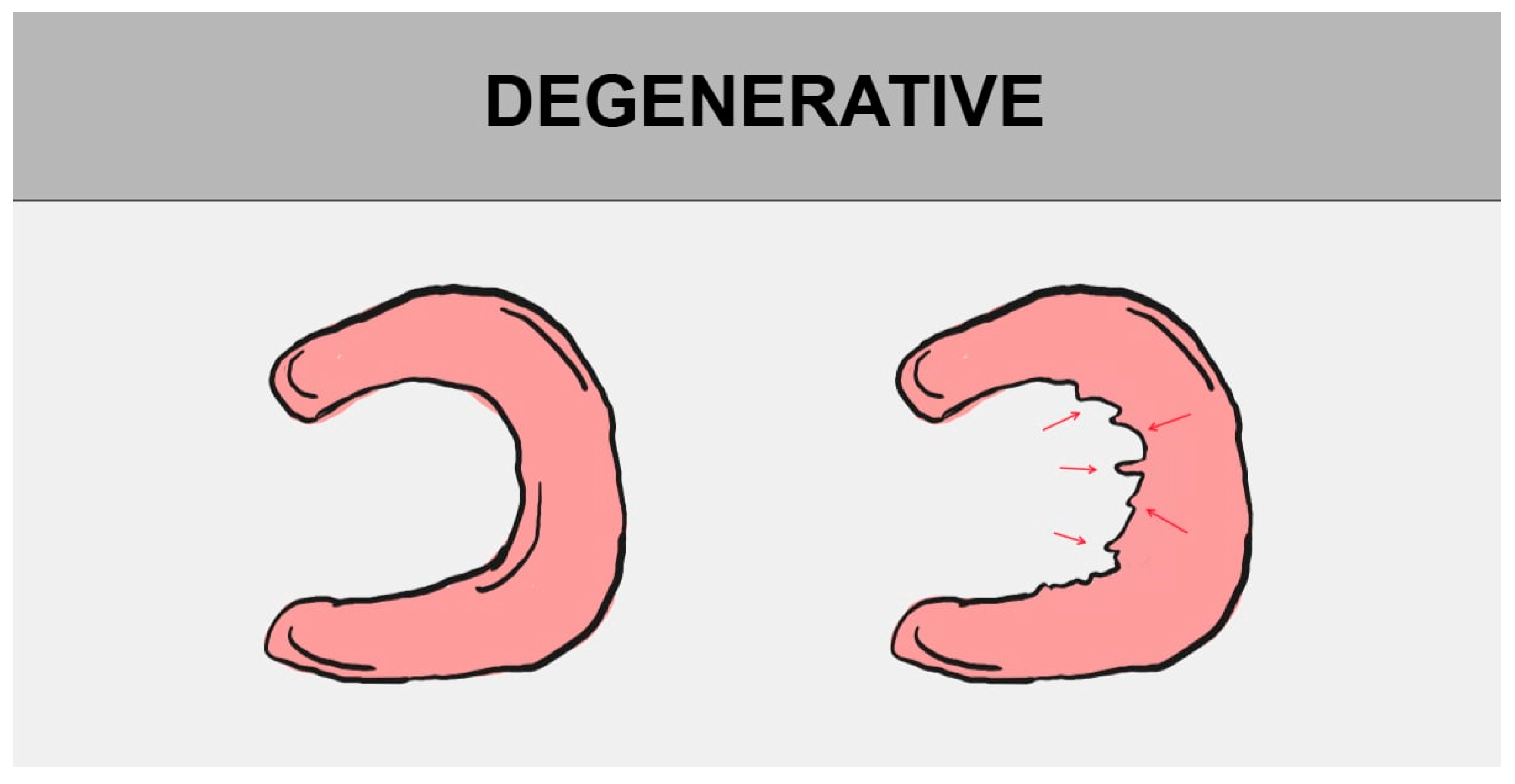 The Meniscus: Basic Science and Therapeutic Approaches