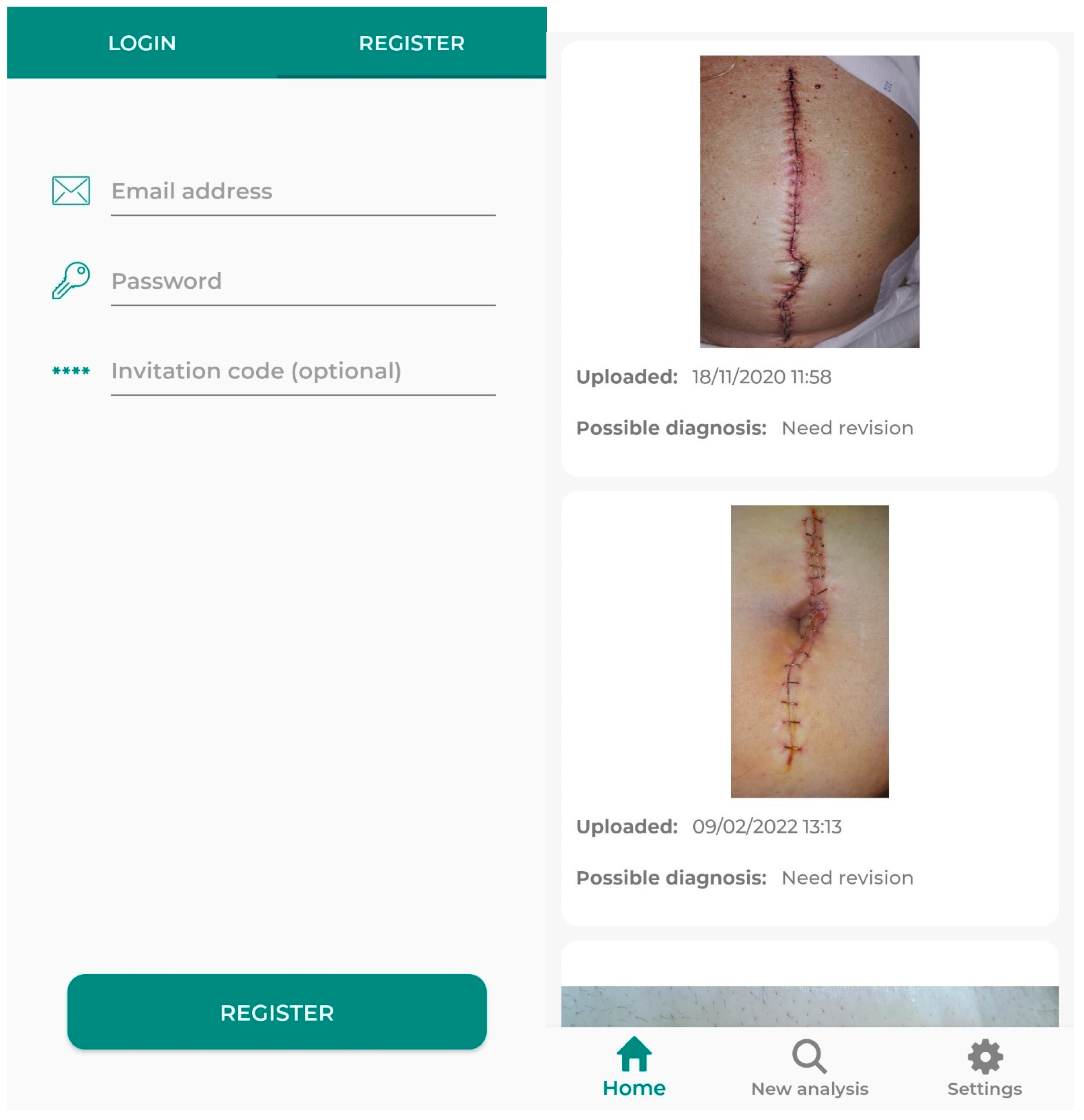 Multicenter Study Protocol: Research on Evaluation and Detection of Surgical Wound Complications ...