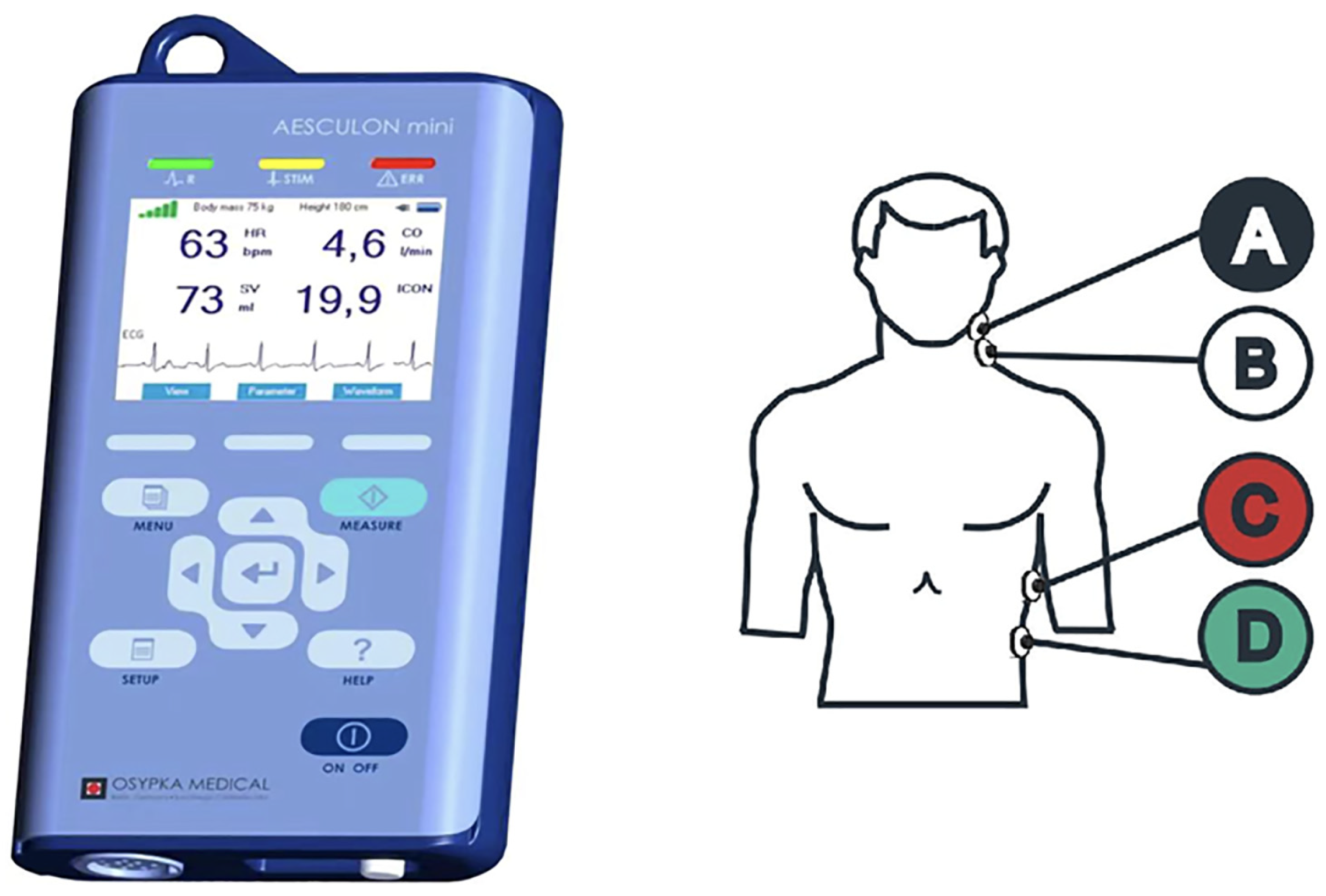 Non-Invasive Cardiac Output Monitoring with Electrical Cardiometry During Laparoscopic ...
