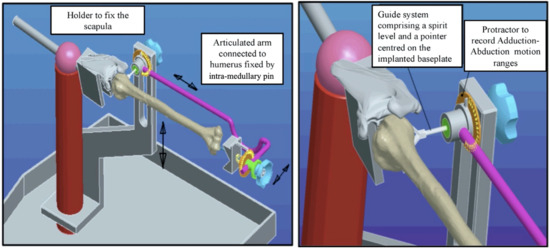 The Influence of the Joint Volume on the Prevention of Impingement and ...