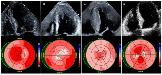 A Practical Approach to Multimodality Imaging in Hypertrophic ...