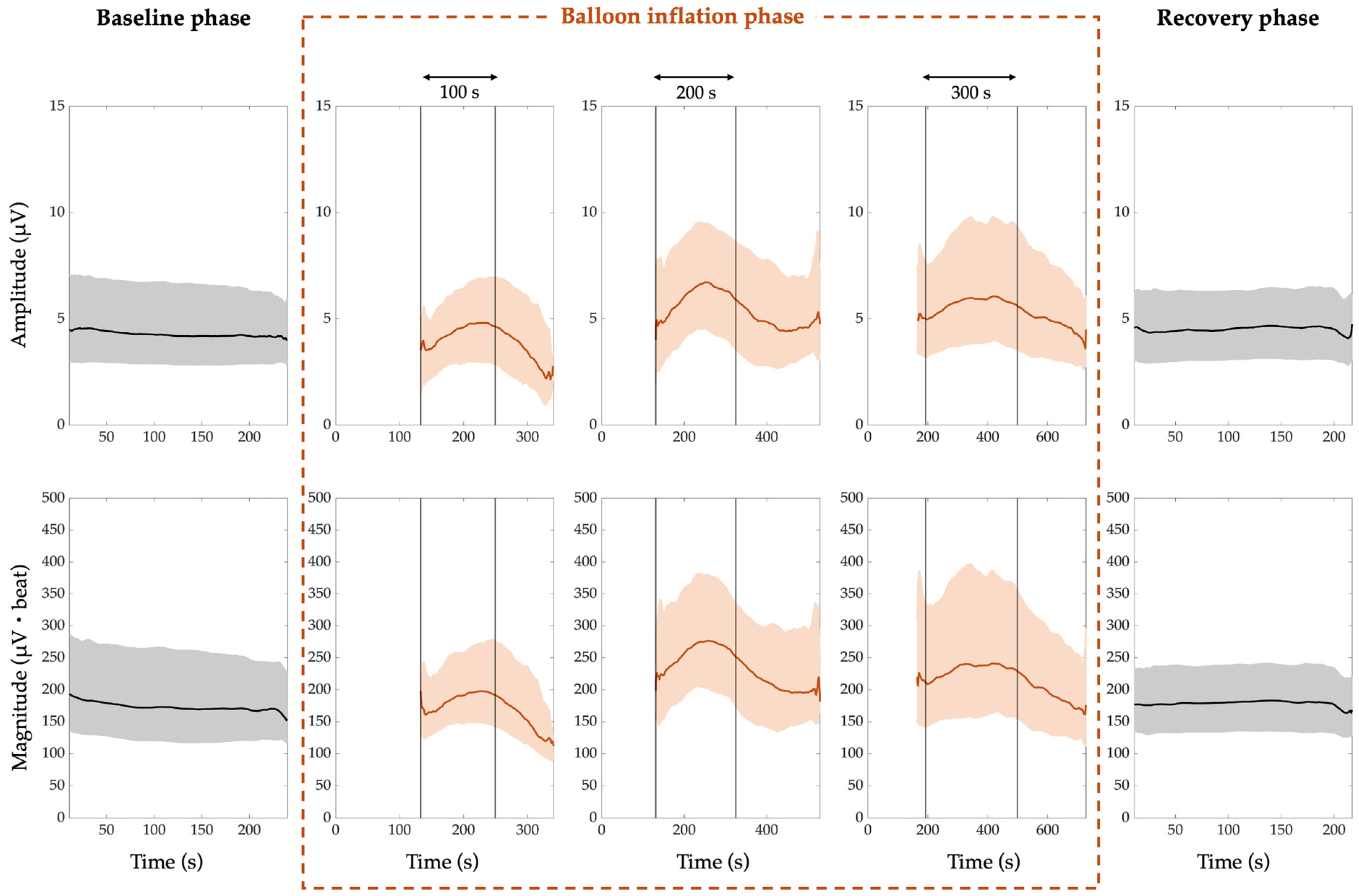 Prognostic Role of Electrocardiographic Alternans in Ischemic Heart Disease
