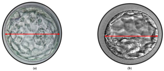 Morphometric Blastocyst Assessment: A Retrospective Study Examining the ...
