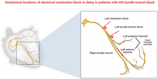 Understanding LOT-CRT: Current Insights, Limitations, and Our Center’s ...