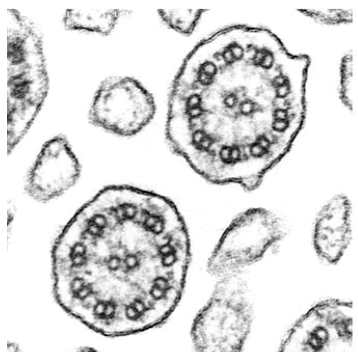 Ciliary Motility and Ultrastructure in Bronchial Epithelium of Lung ...