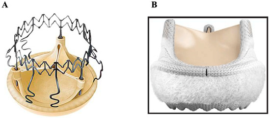 Prosthetic Heart Valves: More than Half a Century of Innovation—An Overview