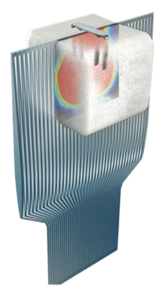 Continuous Compression Implants in Foot and Ankle Surgery: Tips and Tricks