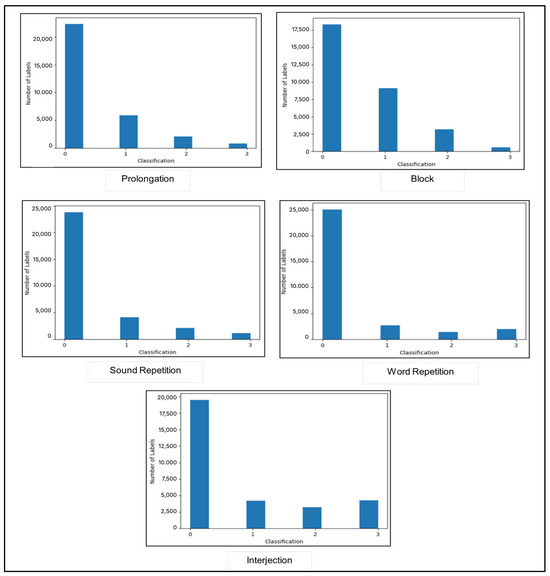 Automated Stuttering Detection Using Deep Learning Techniques