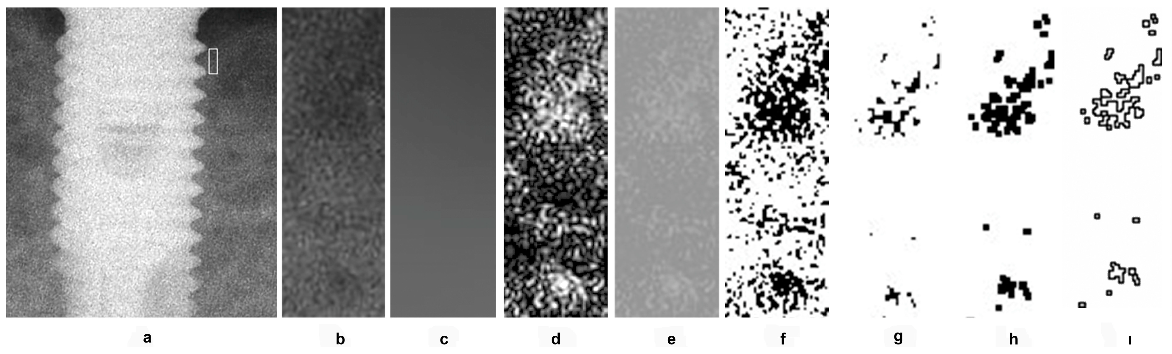 Evaluation of Peri-Implant Bone Changes with Fractal Analysis