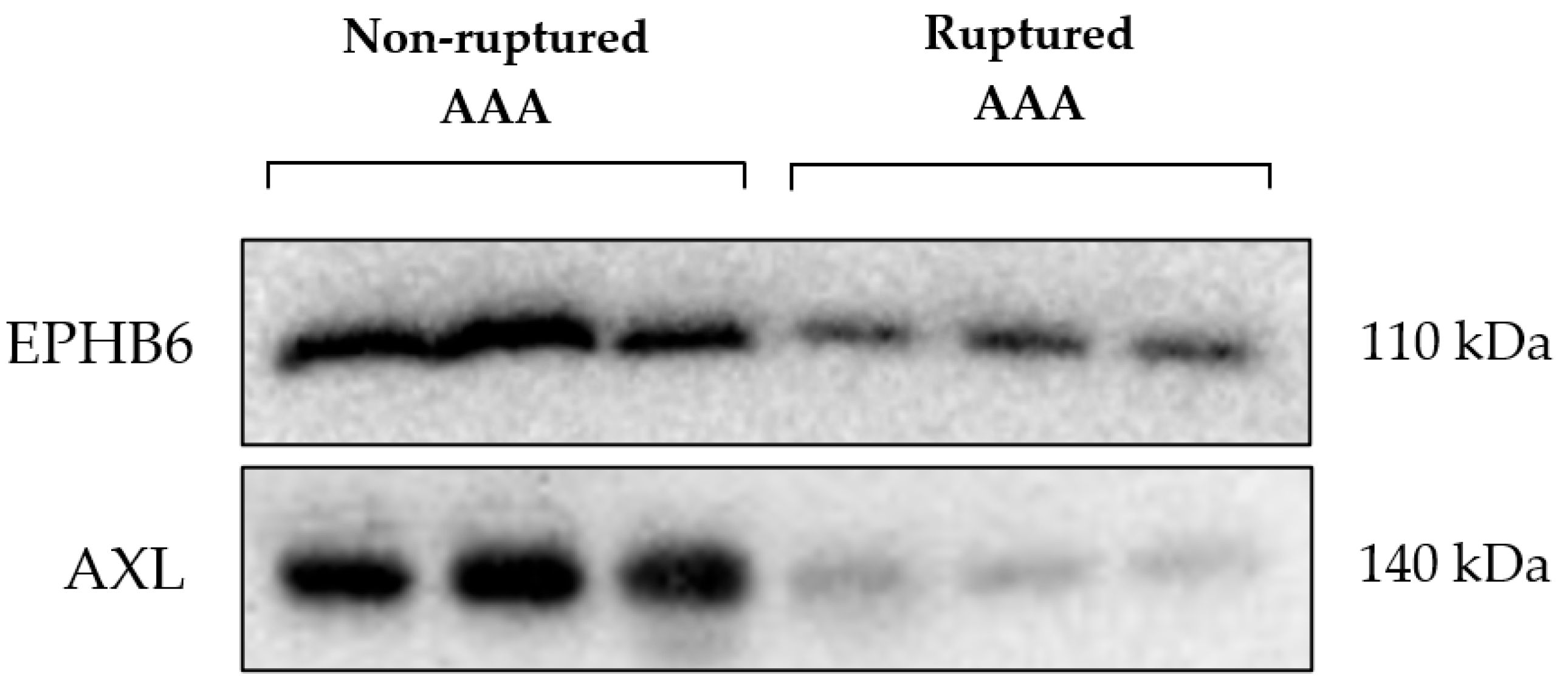Cracking the Kinase Code: Urinary Biomarkers as Early Alarms for AAA ...