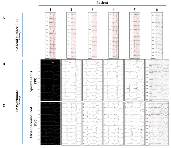 Novel Putative Effectors Identified in the Arrhythmogenesis of ...