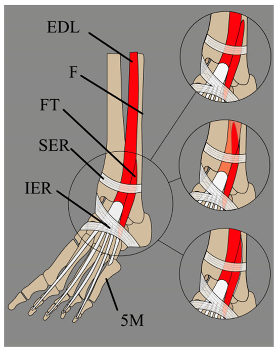 Morphological Variability and Clinical Significance of the Fibularis ...
