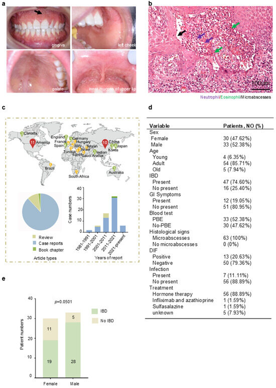 Pyodermatitis–Pyostomatitis Vegetans: The Role of Langerin Deficiency ...