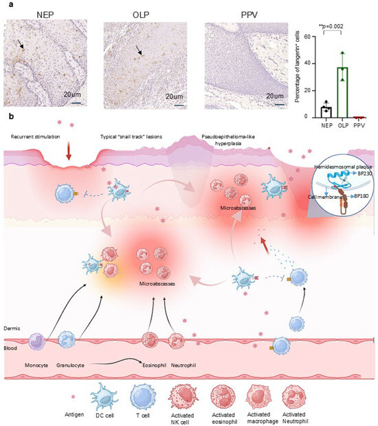 Pyodermatitis–Pyostomatitis Vegetans: The Role of Langerin Deficiency ...