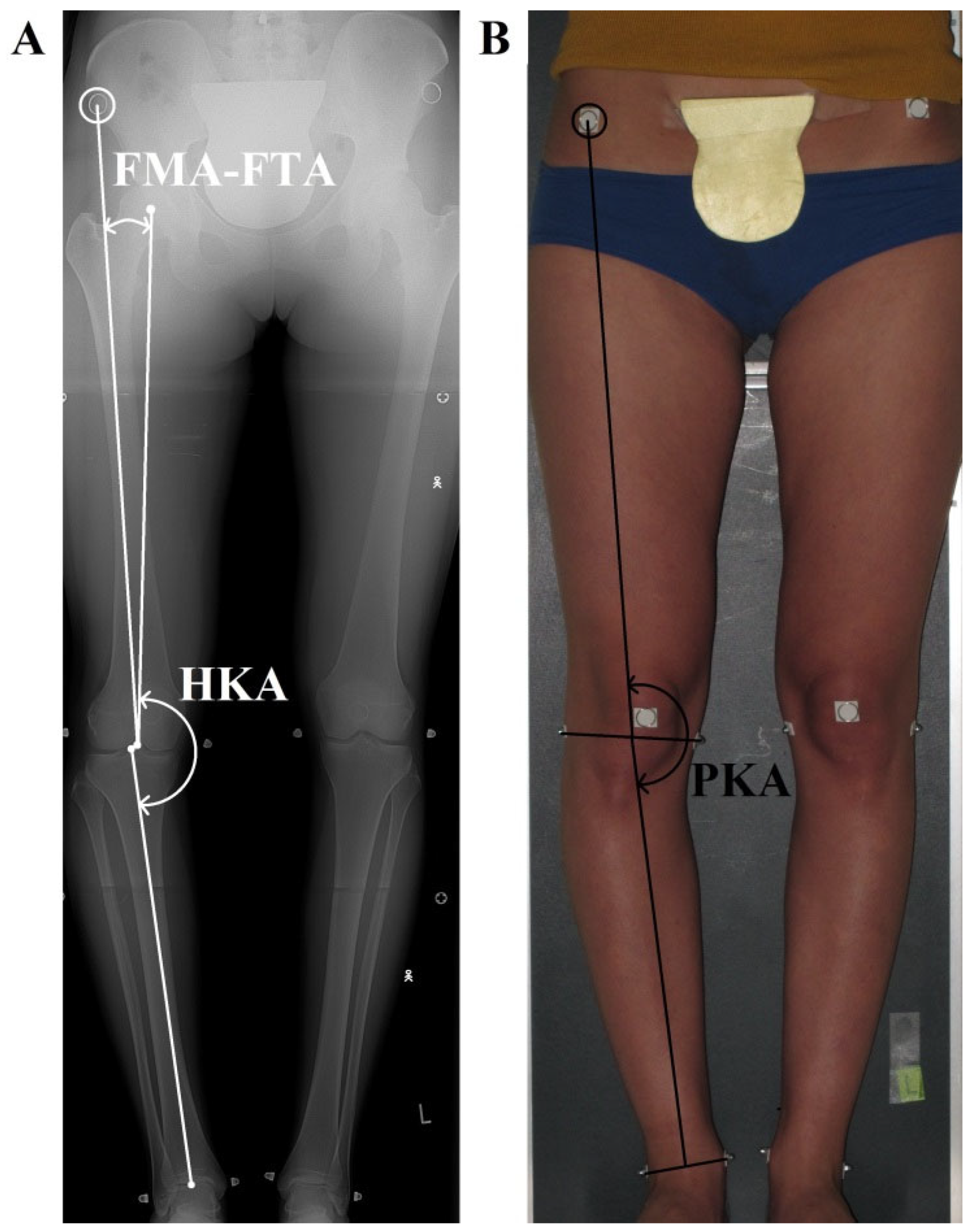The Accuracy and Reliability of the Photometric Method—A New Noninvasive Tool for Assessing ...