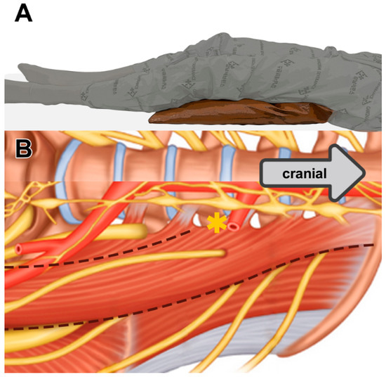 Advances in Clinical Outcomes of Endoscopic Lumbar Sympathectomy ...