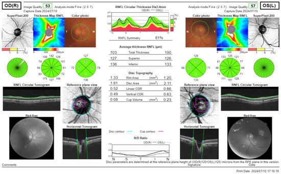 The Value of Optical Coherence Tomography in Patients with Pituitary ...