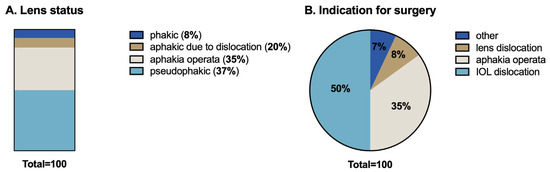 Implantation of Sutureless Scleral-Fixated Carlevale Intraocular Lens ...
