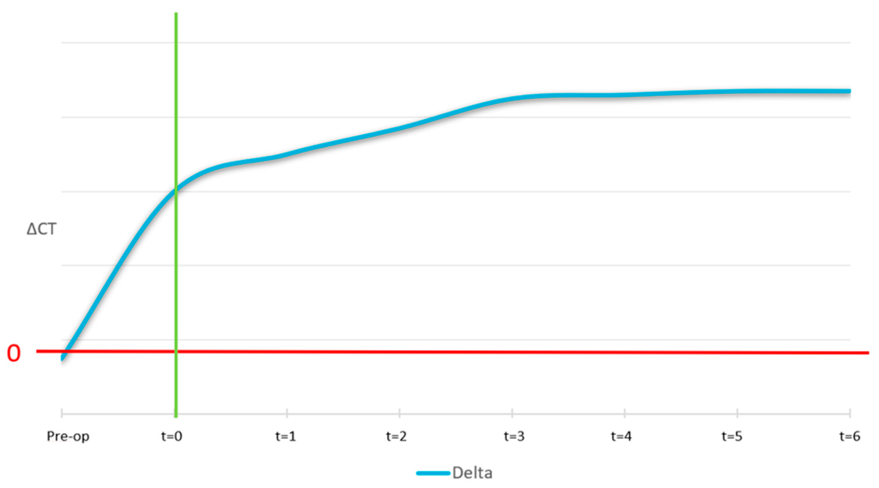 Bone Selective Remodeling of Xeno-Hybrid Grafts: A Case Series