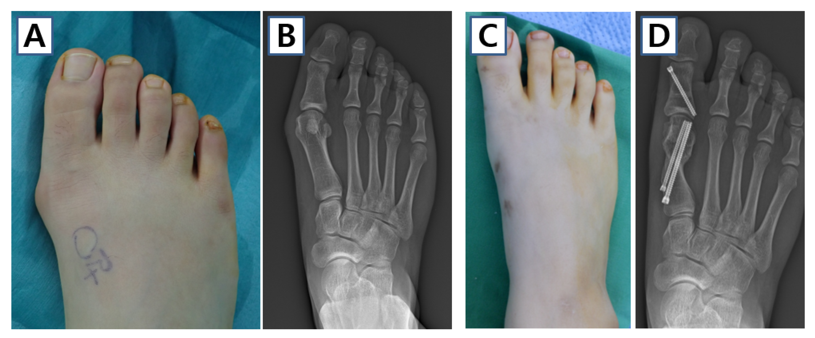 Current Concepts of Radiographic Evaluation and Surgical Treatment for ...