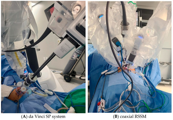 Comparing Two Types of Robotic Single-Site Myomectomy Using Propensity ...