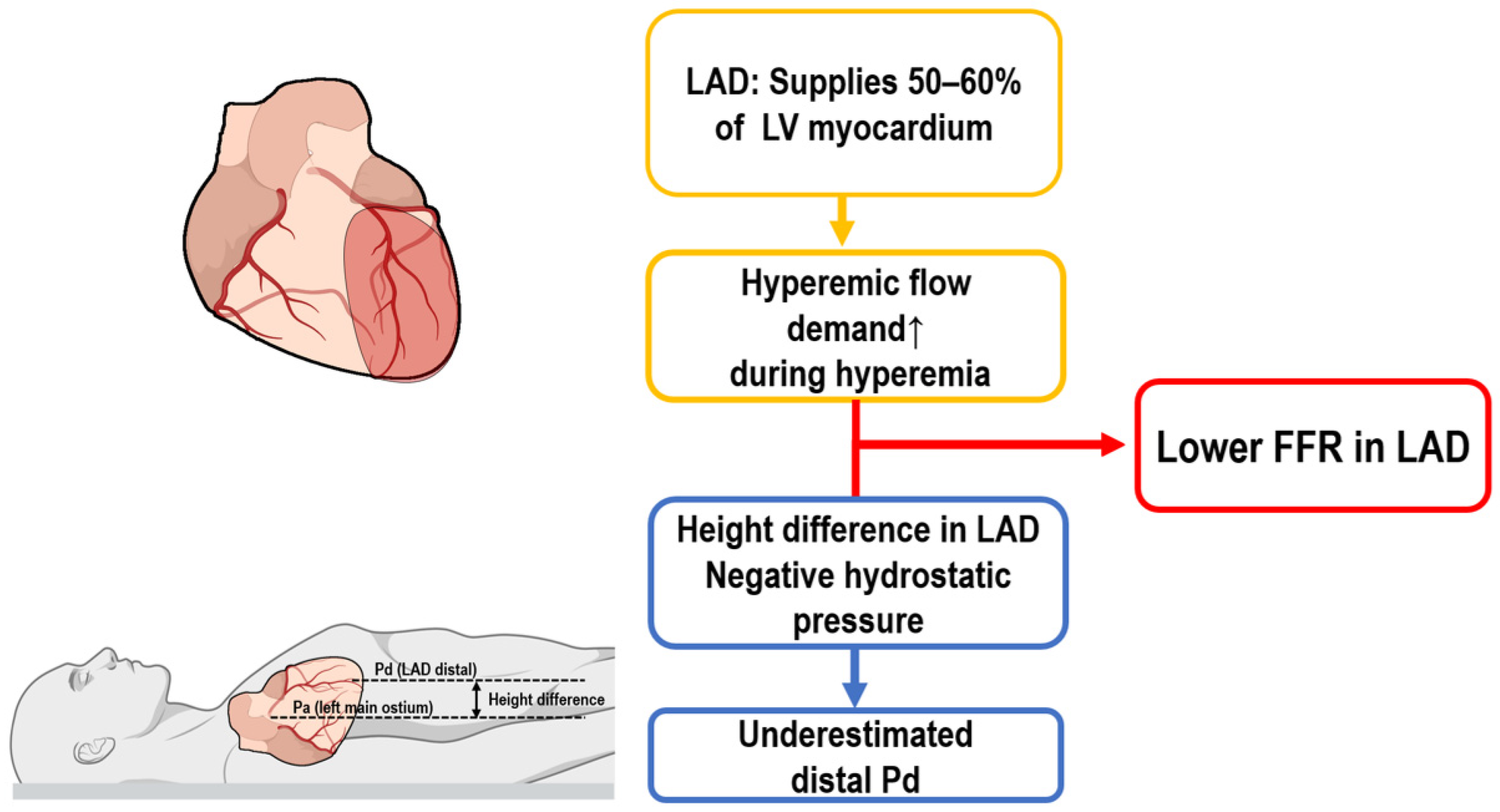 Fractional Flow Reserve in the Left Anterior Descending Artery