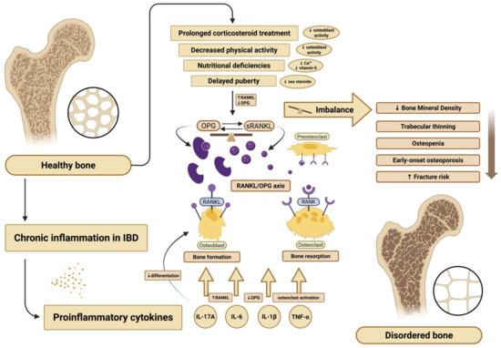 RANKL/OPG Axis and Bone Mineral Density in Pediatric Inflammatory Bowel ...