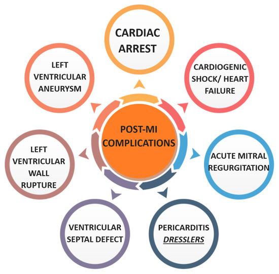 Review of Current Management of Myocardial Infarction
