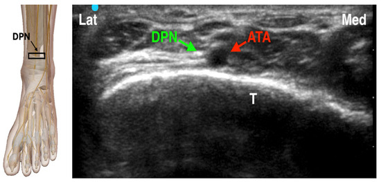 Perioperative Analgesia for Foot and Ankle Surgery: A Comprehensive Review
