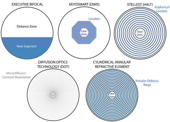 Next-Generation Spectacle Lenses for Myopia Control: Optical Designs ...