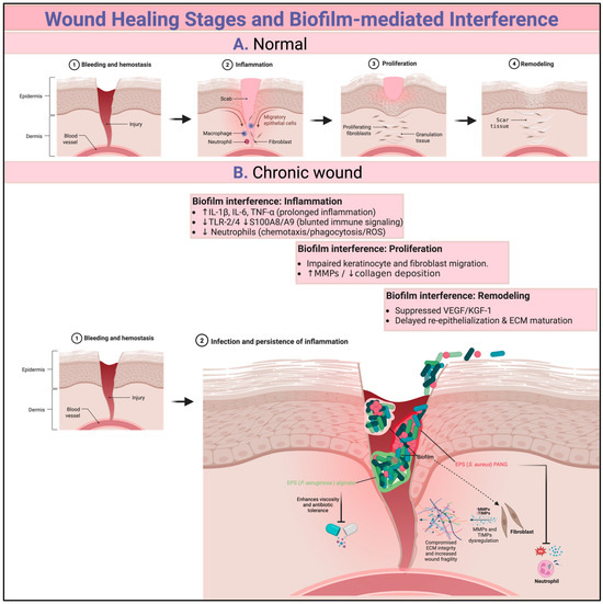 Microbial Biofilms as Barriers to Chronic Wound Healing: Diagnostic ...