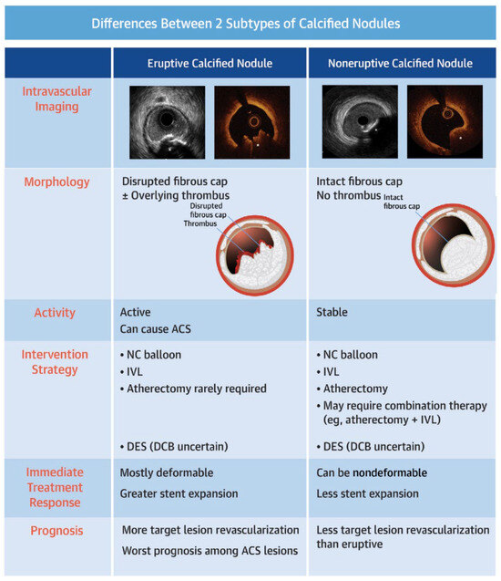 Use of Calcium Modification in Percutaneous Coronary Intervention: A ...