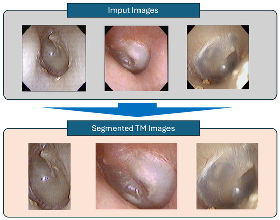Development and Validation of a CNN-Based Diagnostic Pipeline for the ...