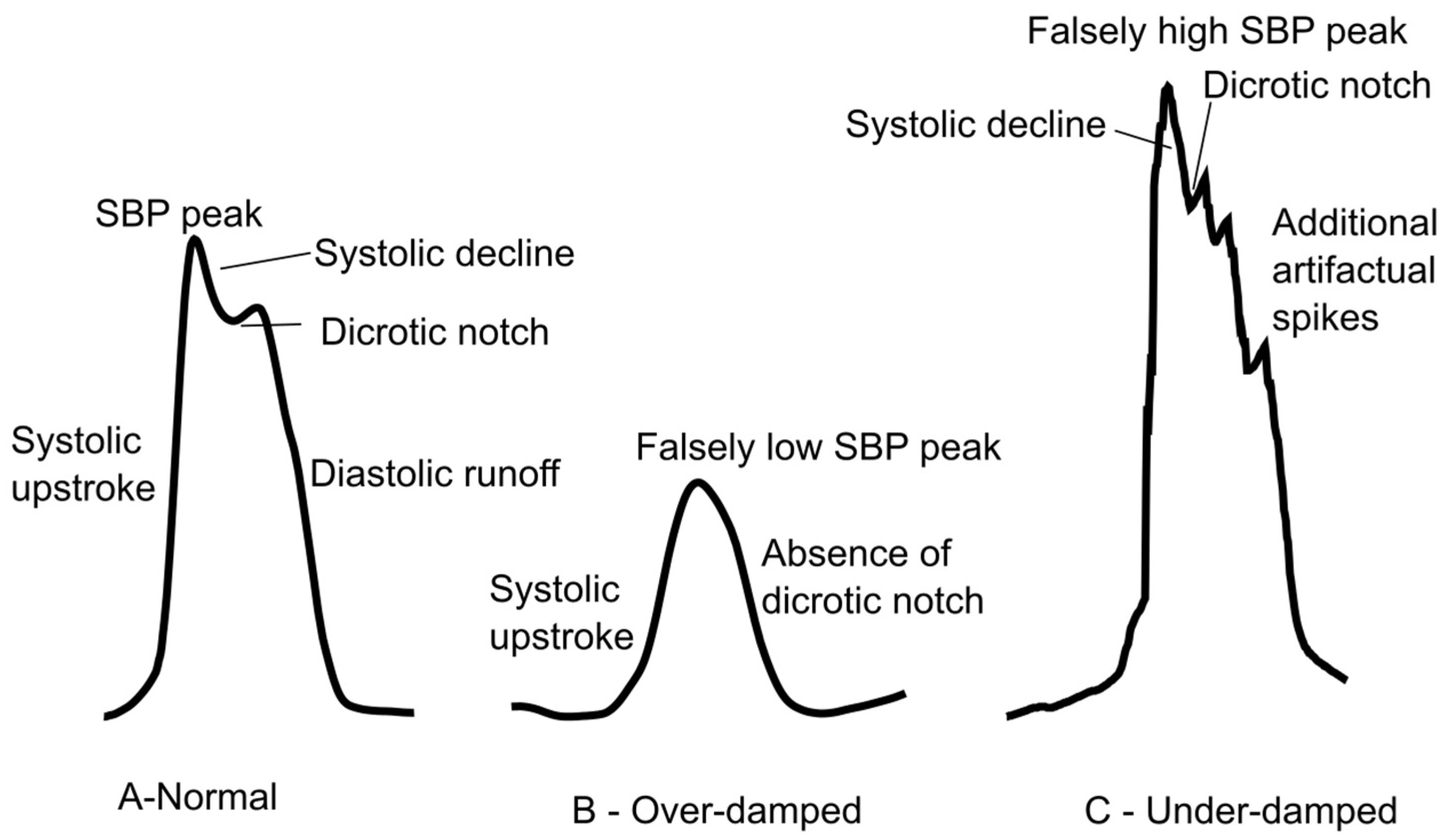 Should I Target the Blood Pressure from the Arterial Line or the Cuff ...