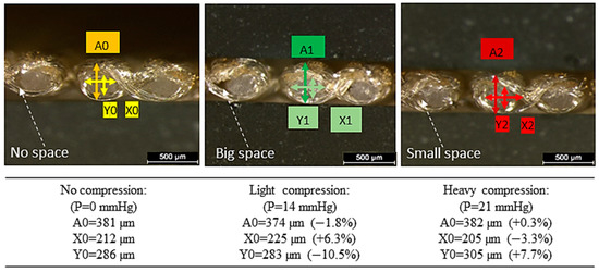 A Self-Pumping Composite Dressing Improved Hypertrophic Scar Healing ...