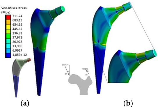 Topology Optimization of a Femoral Stem in Titanium and Carbon to ...