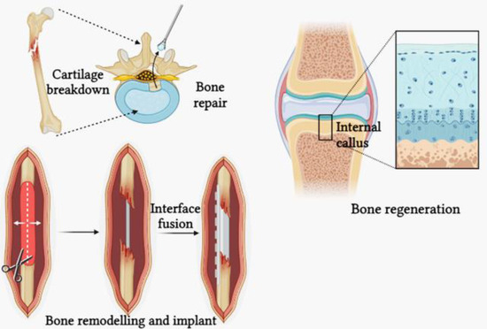 A Short Review on Chondroitin Sulphate and Its Based Nanomaterials for ...