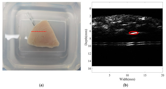 Miniature Ultrasound Transducer Incorporating Sm-PMN-PT 1-3 Composite