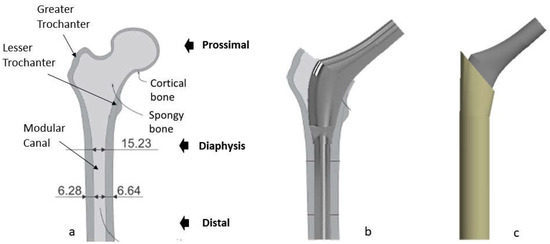 A Finite Element Analysis Study of Influence of Femoral Stem Material ...