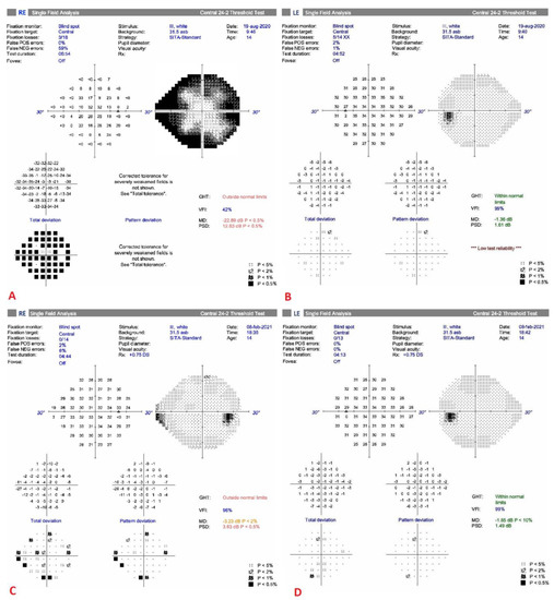 Visual Rehabilitation in Post Mild Traumatic Brain Injury. Case-Based ...