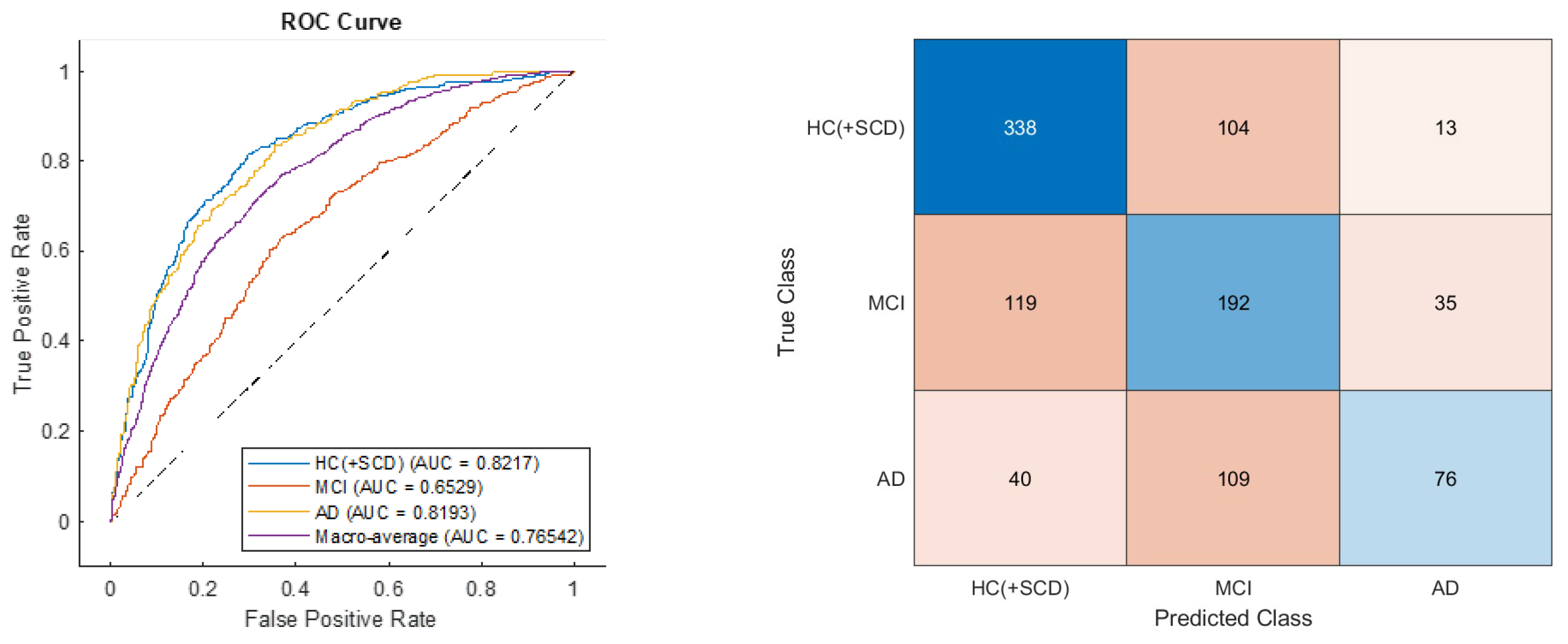 Exploring Functional Brain Networks in Alzheimer’s Disease Using ...