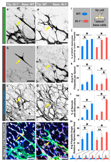 Blood Vessel Patterning on Retinal Astrocytes Requires Endothelial Flt ...