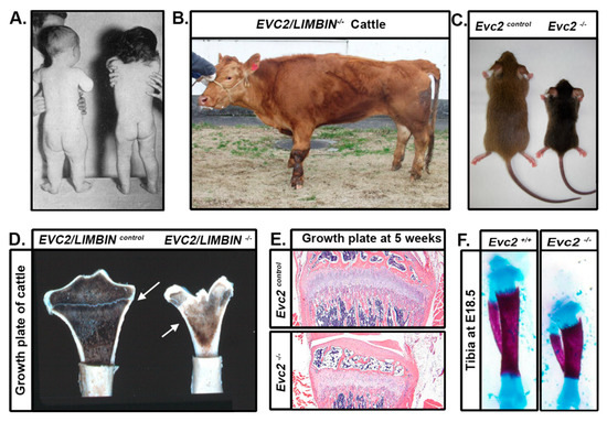 Molecular and Cellular Pathogenesis of Ellis-van Creveld Syndrome ...