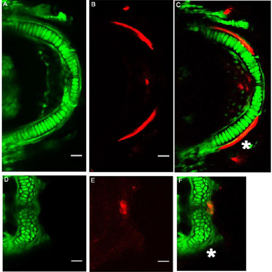 The Shape of the Jaw—Zebrafish Col11a1a Regulates Meckel’s Cartilage ...